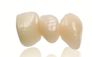 All-Ceramics | Make it emax | Ivoclar