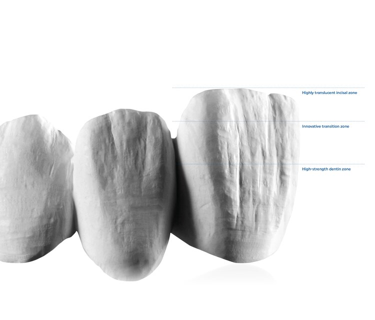 IPS e.max ZirCAD Prime: where and how does it achieve top marks?