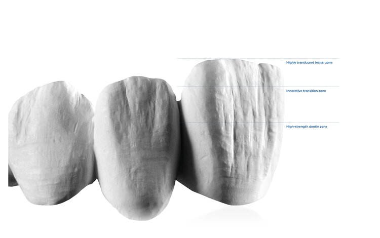 Prime Zirconia Case Guide | Dental Zirconia | Ivoclar USA