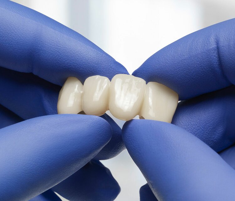 The benefits of Prime Zirconia : Ivoclar