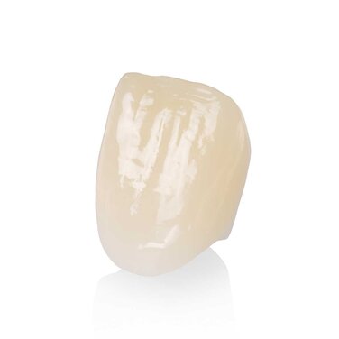 IPS e.max Press | Metal-free Dental Ceramics | Ivoclar LI