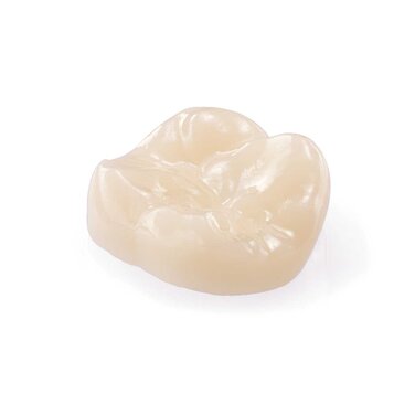 IPS e.max Press | Metal-free Dental Ceramics | Ivoclar LI