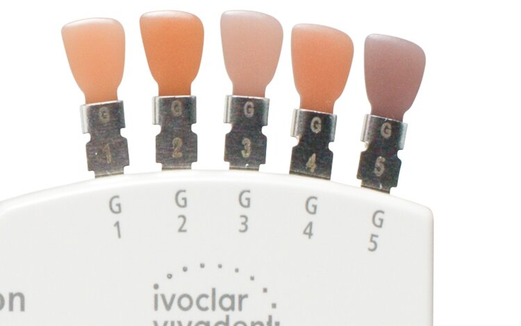 IPS e.max Ceram Gingiva | Dental Gum Restorations | Ivoclar USA