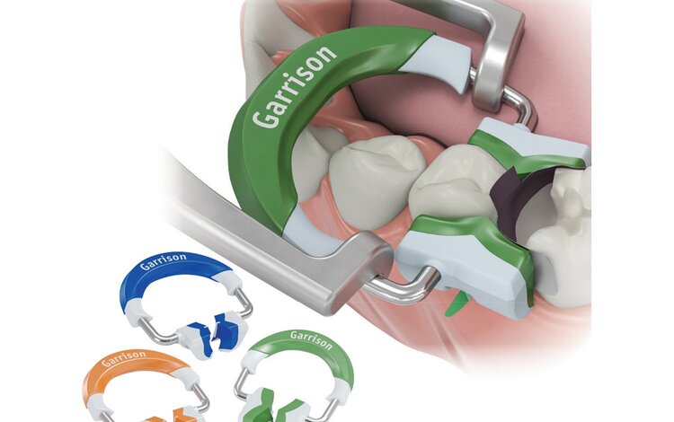 Garrison Sectional & Tofflemire Matrix Systems