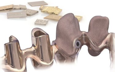 Maxigold | Dental Alloys | Ivoclar USA