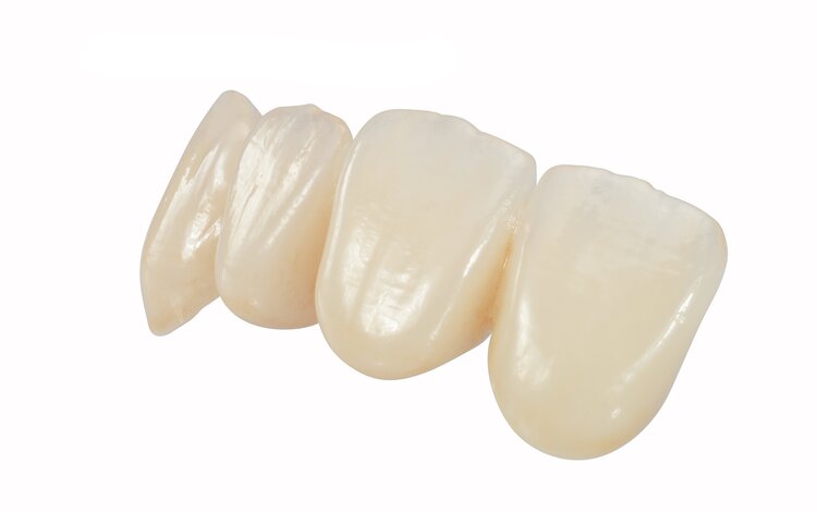Prime Zirconia | Zirconia Dental Restorations | Ivoclar USA