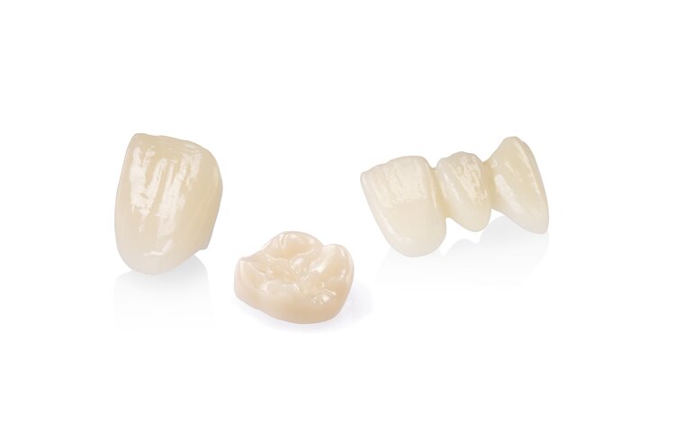IPS e.max Press | Glass Ceramic Restorations | Ivoclar