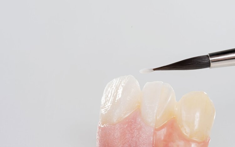 IPS e.max Ceram Art | Ceramic stain and glaze pastes | Ivoclar LI