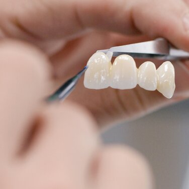 Zirconia Dental Restorations | Dental Workflows | Ivoclar USA