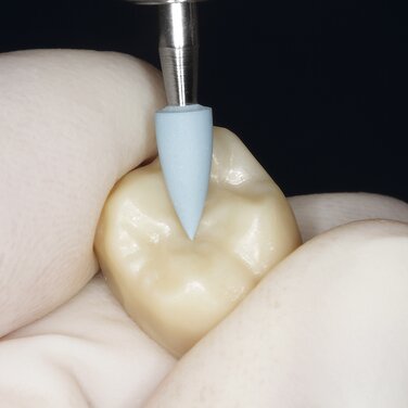 IPS e.max ZirCAD Chairside | Zirconia Restorations | Ivoclar AU
