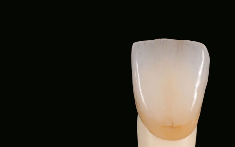 IPS e.max Ceram Art | Ceramic stain and glaze pastes | Ivoclar