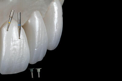 The Staining Technique: All-Ceramic Restorations | Blog | Ivoclar USA