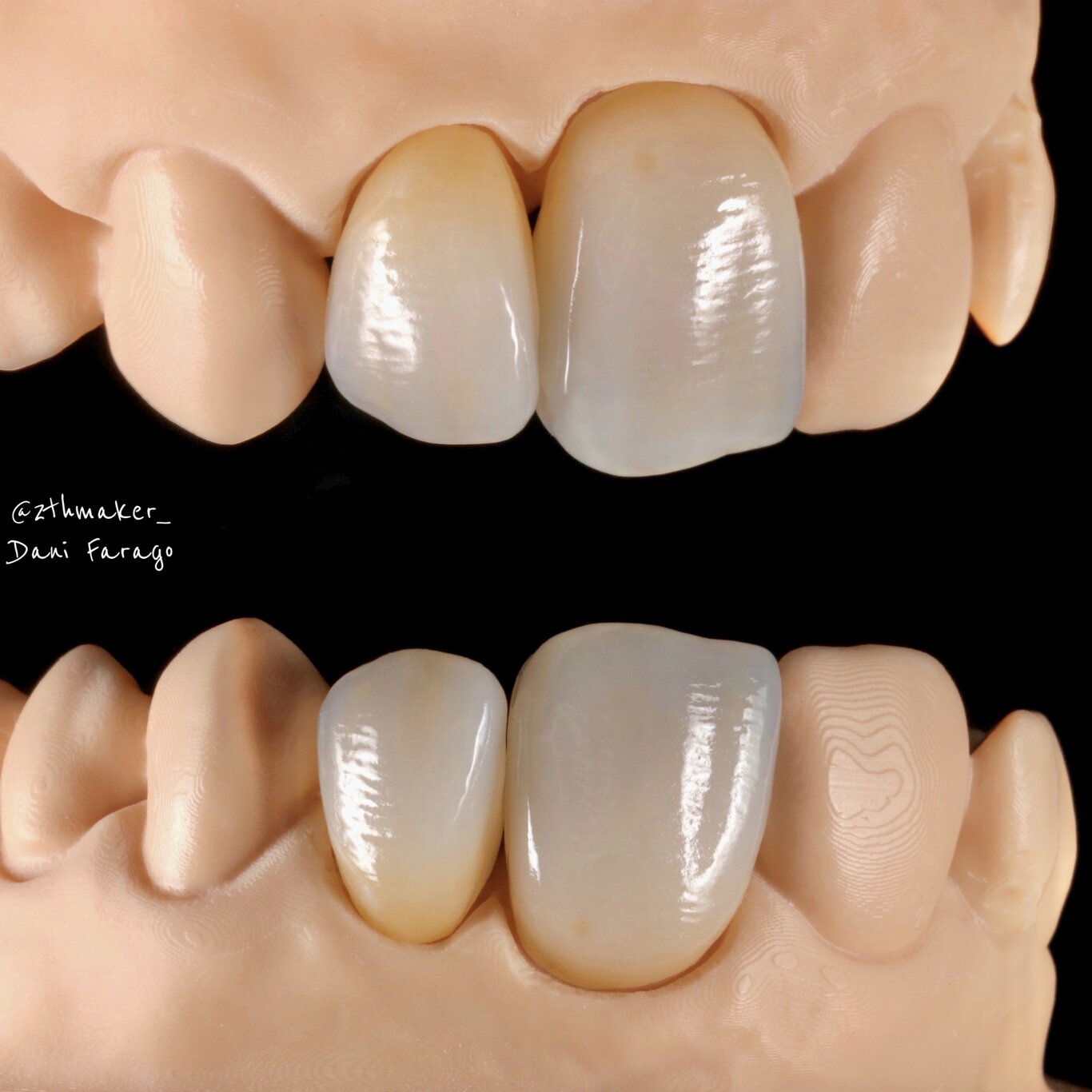 An interview with Dani Farago about all-ceramic materials : Ivoclar