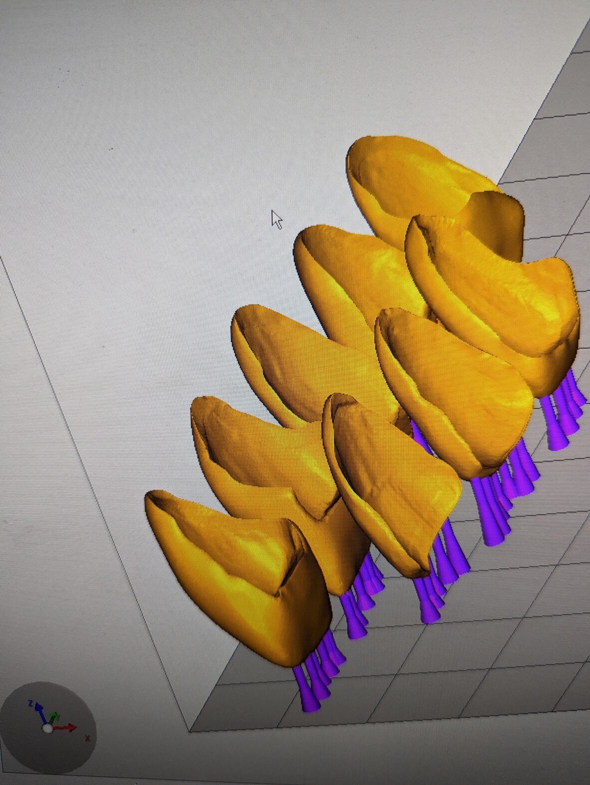 The Heart of Digital Dentistry Isn't CAD/CAM; It’s Design | Blog ...