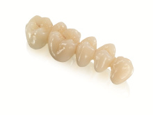 IPS e.max CAD Crystall./Shade 3g | All Ceramics | Ivoclar Vivadent US